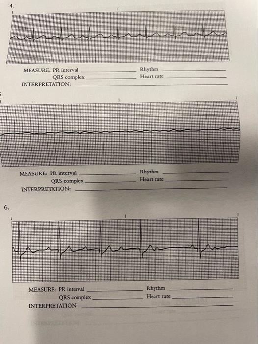 Solved MEASURE: PR interval Rhythm QRS complex Heart rate | Chegg.com