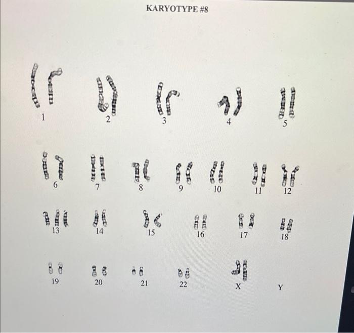 Solved 6. Examine the following karyotypes and answer the | Chegg.com