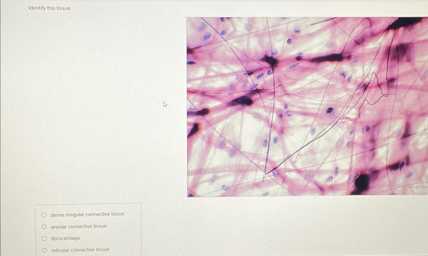 Solved Identify this tissuedense irregular connective | Chegg.com