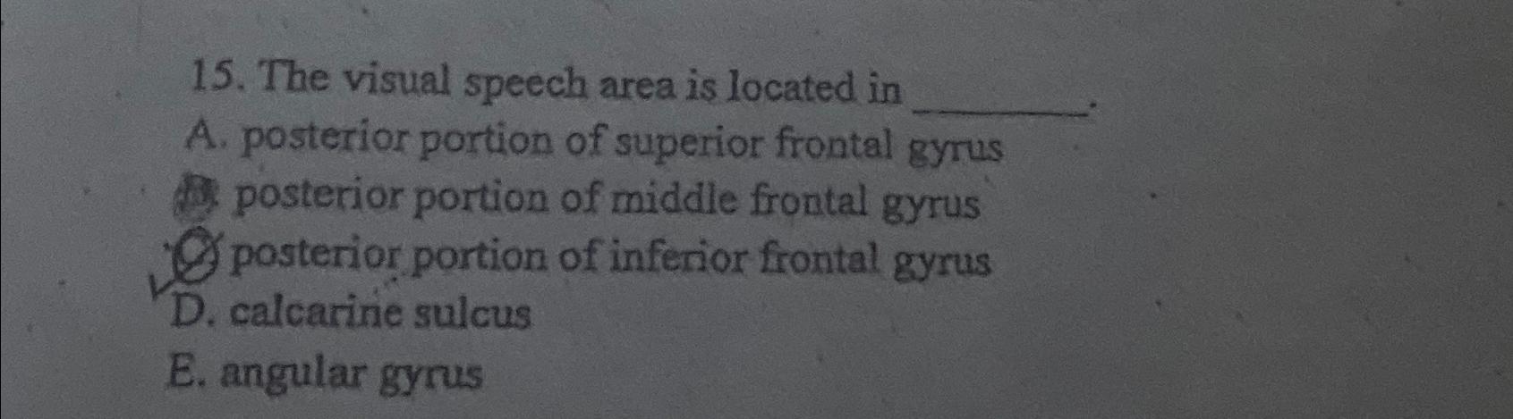 Solved The visual speech area is located in ﻿A. ﻿posterior | Chegg.com