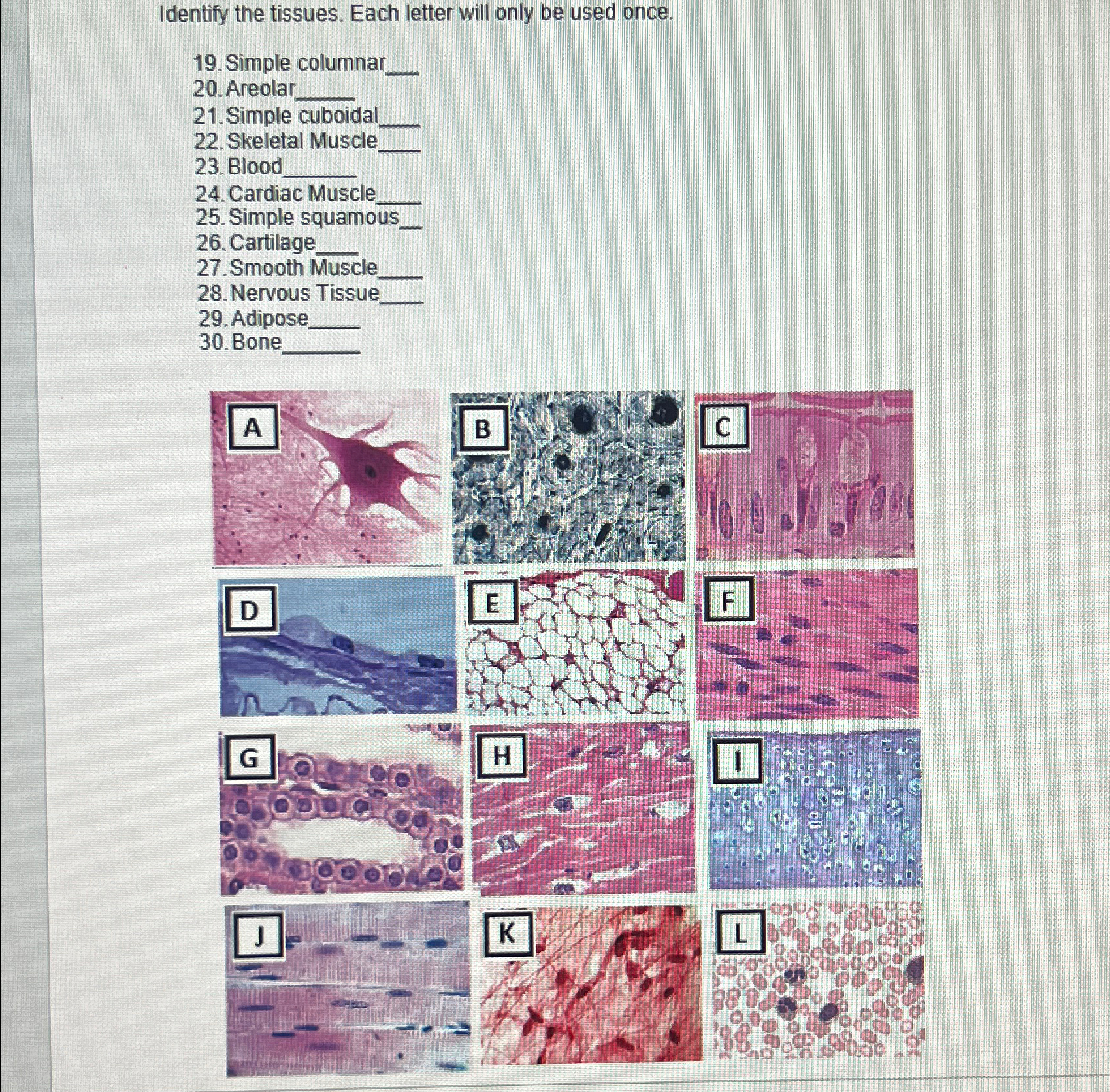 Solved Identify the tissues. Each letter will only be used | Chegg.com
