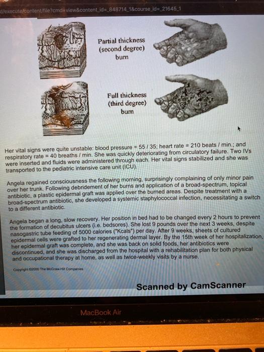 Solved AP 1 Clinical Case Integumentary System Chief | Chegg.com