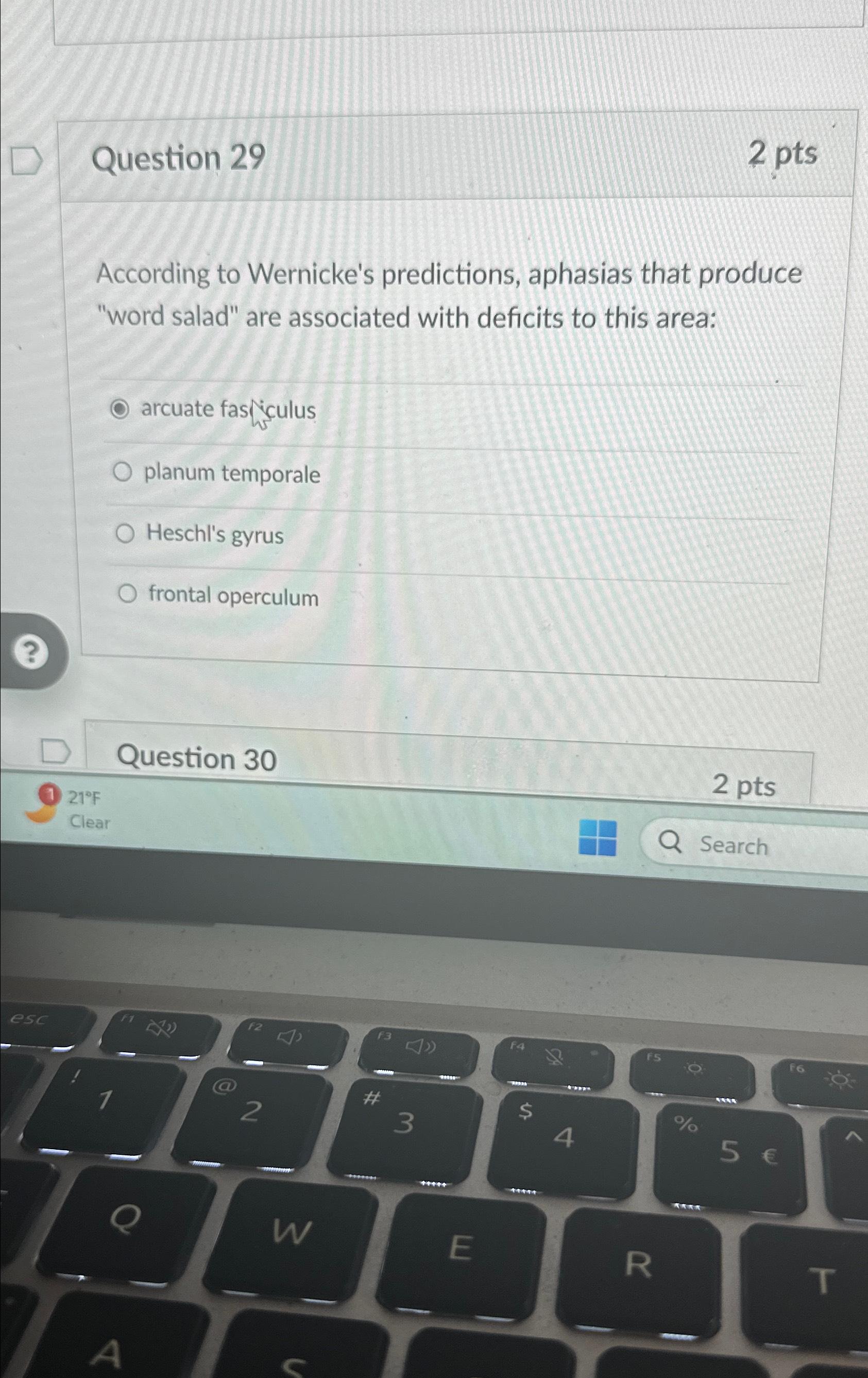 Solved Question 292 ﻿ptsAccording to Wernicke's predictions, | Chegg.com