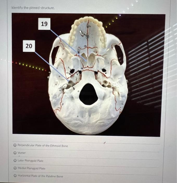 Solved Identify the pinned structure. Perpendicular. Plate | Chegg.com
