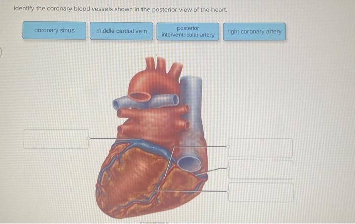 Solved Identify the coronary blood vessels shown in the | Chegg.com