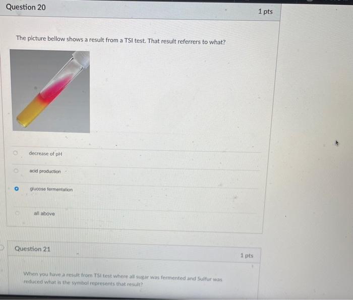 Solved After the incubation period, the Enterotube number | Chegg.com
