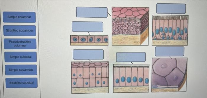 Solved Simple columnar Stratified squamous DO GO000 DOOR | Chegg.com