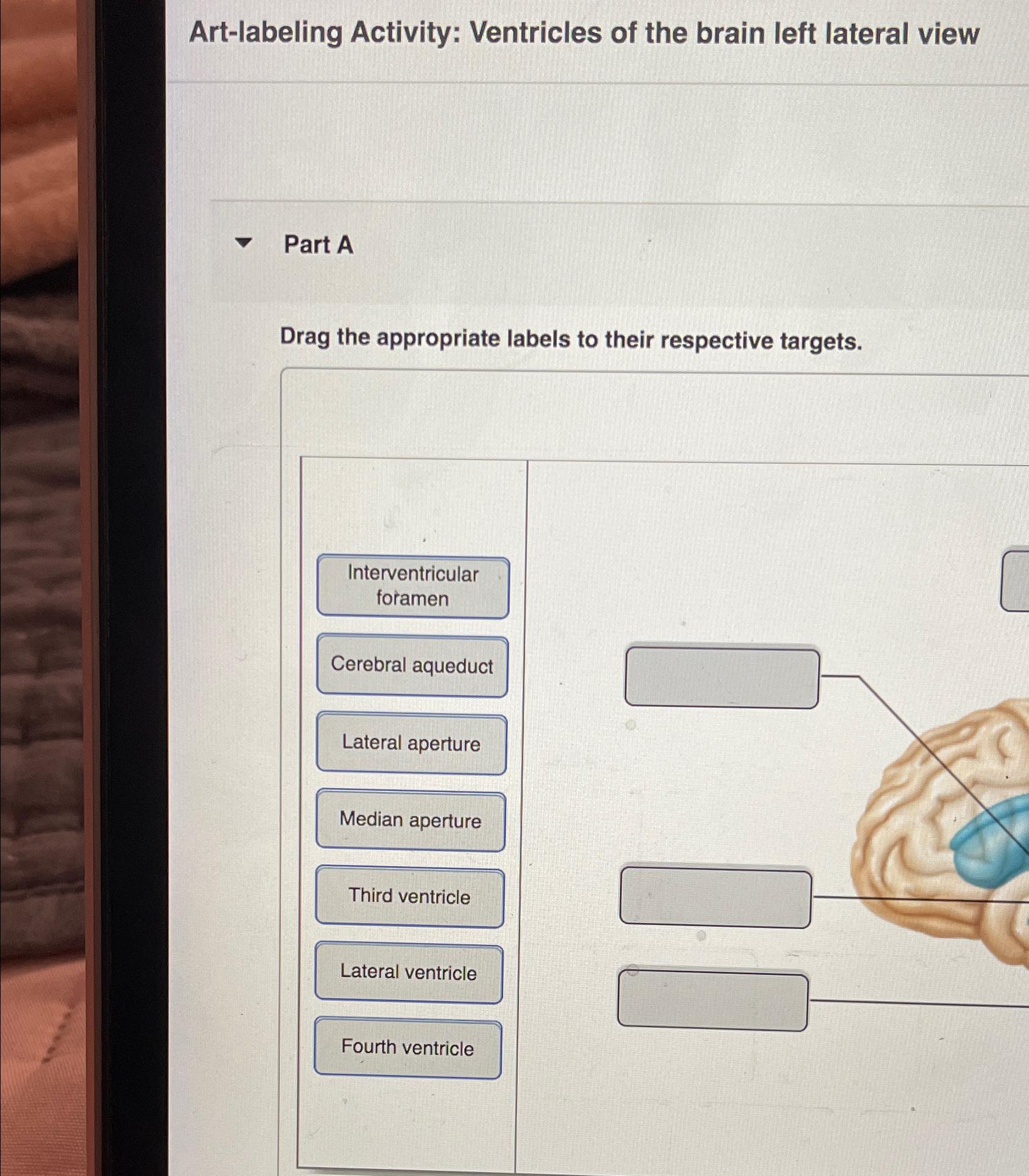 Solved Art-labeling Activity: Ventricles of the brain left | Chegg.com