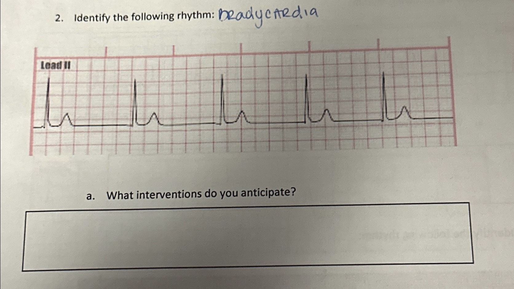 Solved Identify the following rhythm: a. ﻿What interventions | Chegg.com