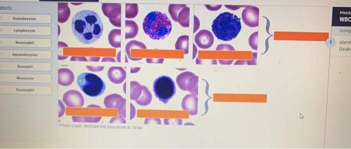 Solved abels Granulocytes PHASI WBC lymphocyte Como | Chegg.com