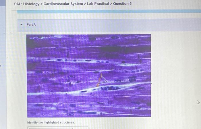 Solved PAL: Histology > Cardiovascular System > Lab | Chegg.com
