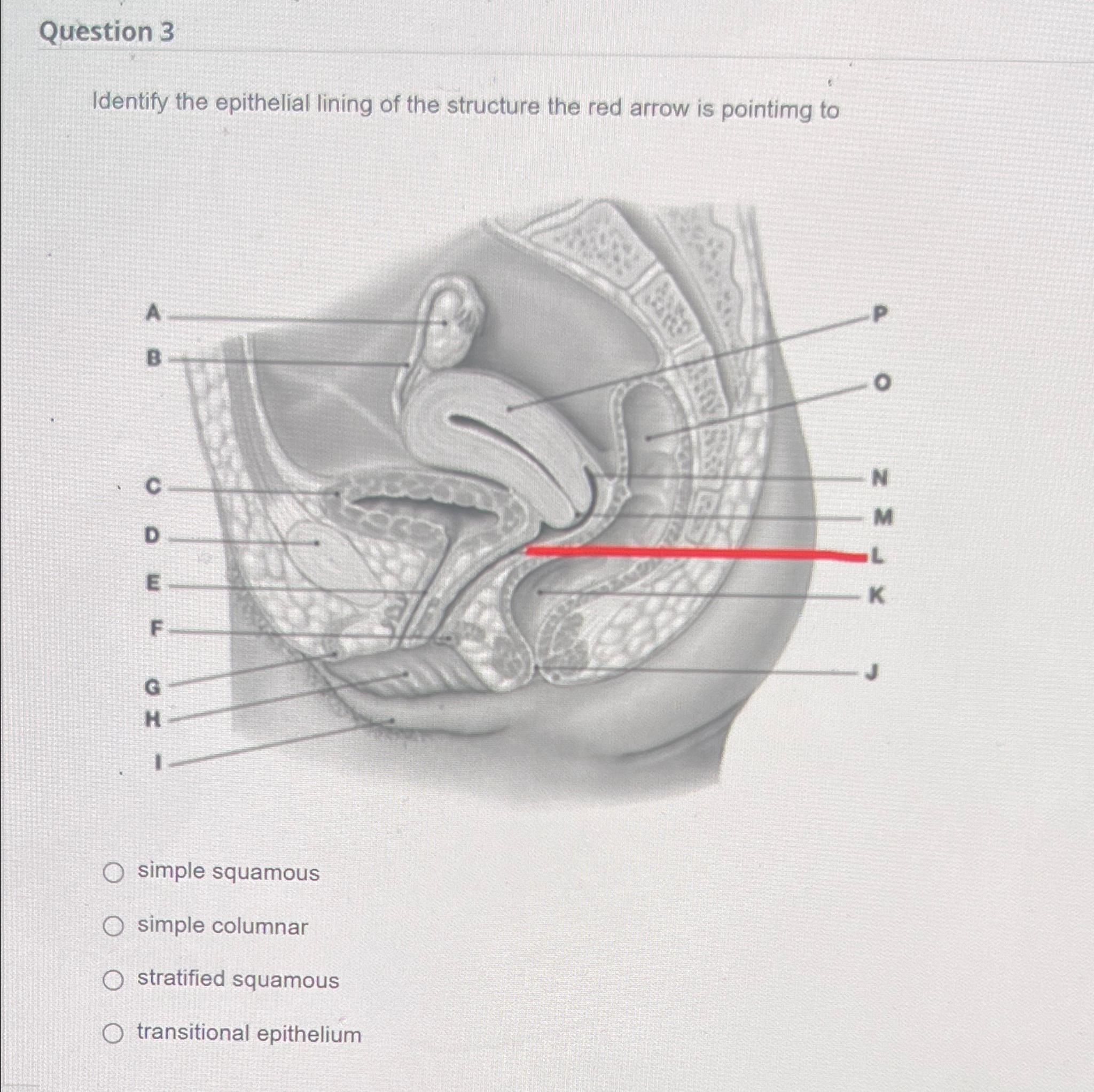 Solved Question 3Identify the epithelial lining of the | Chegg.com