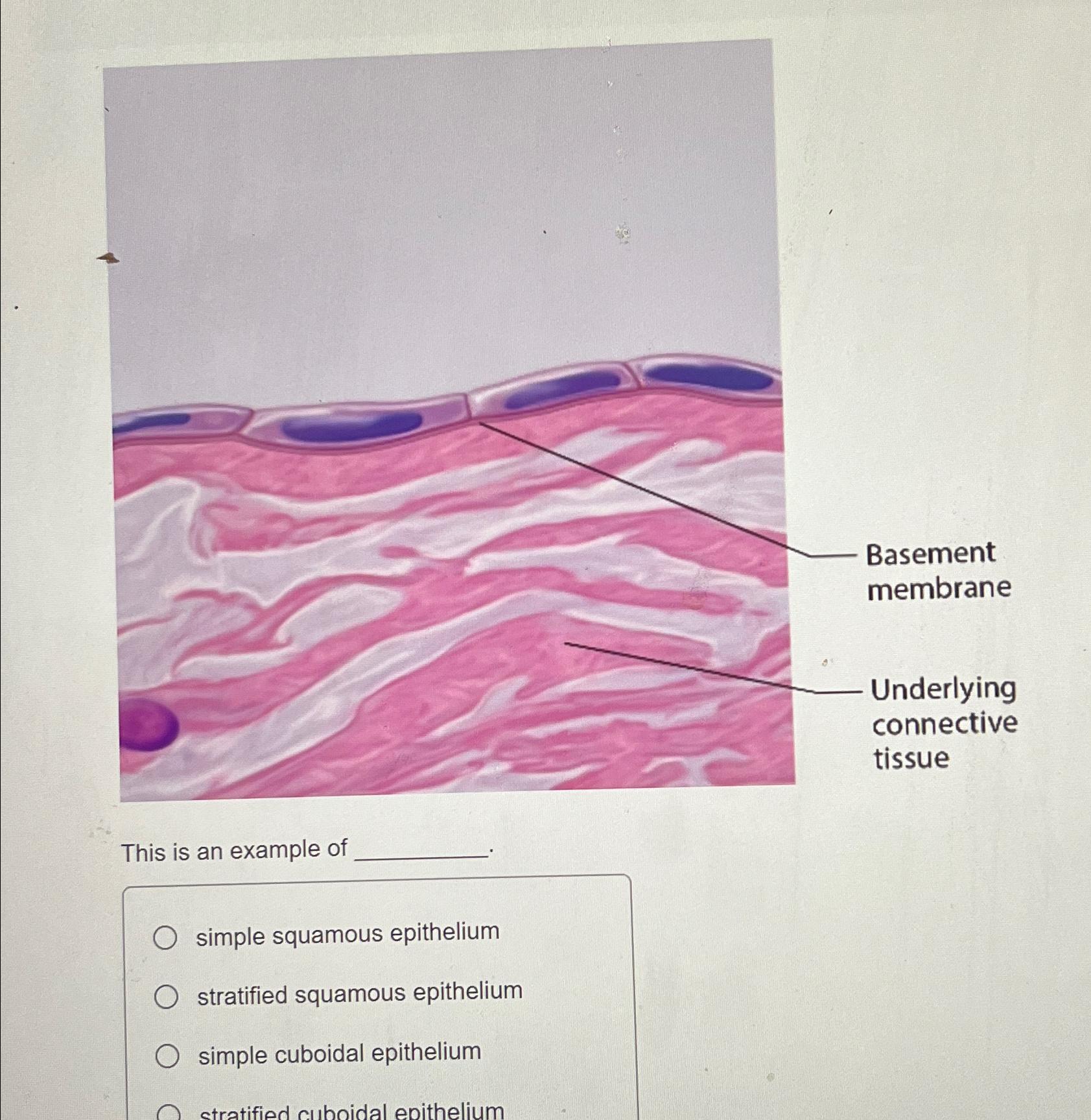 Solved This is an example ofsimple squamous | Chegg.com