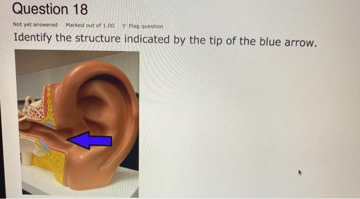 Solved Identify the structure indicated by the tip of the | Chegg.com