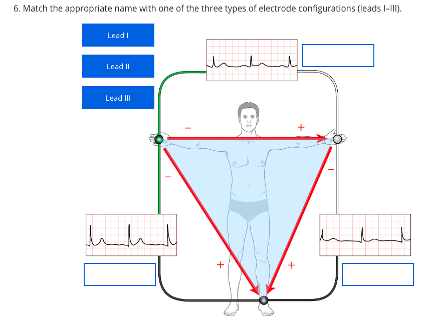 Solved Match the appropriate name with one of the three | Chegg.com