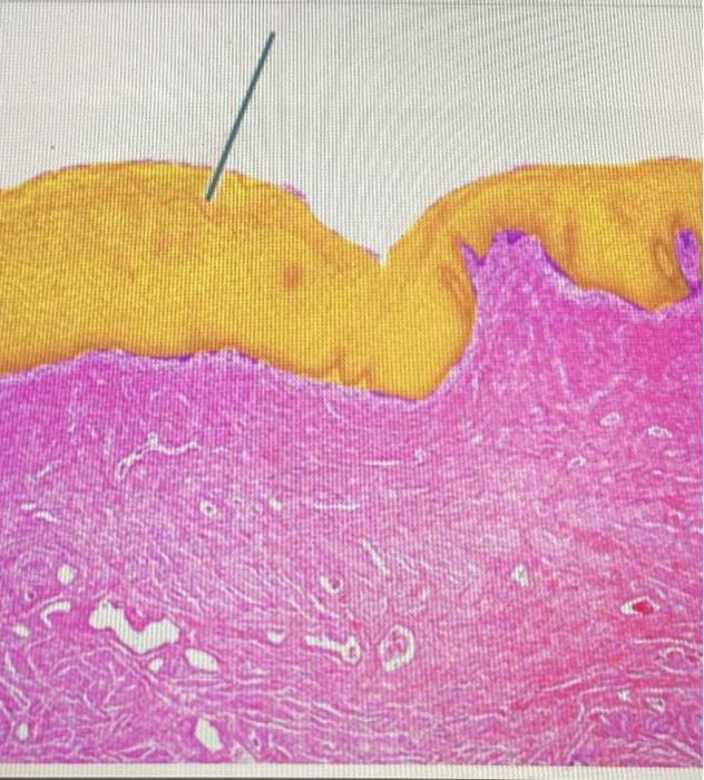 Solved identify the highlighted epithelium | Chegg.com
