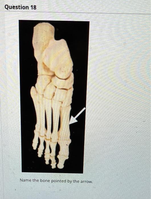 Solved Question 17 Name the bone marking pointed by the | Chegg.com