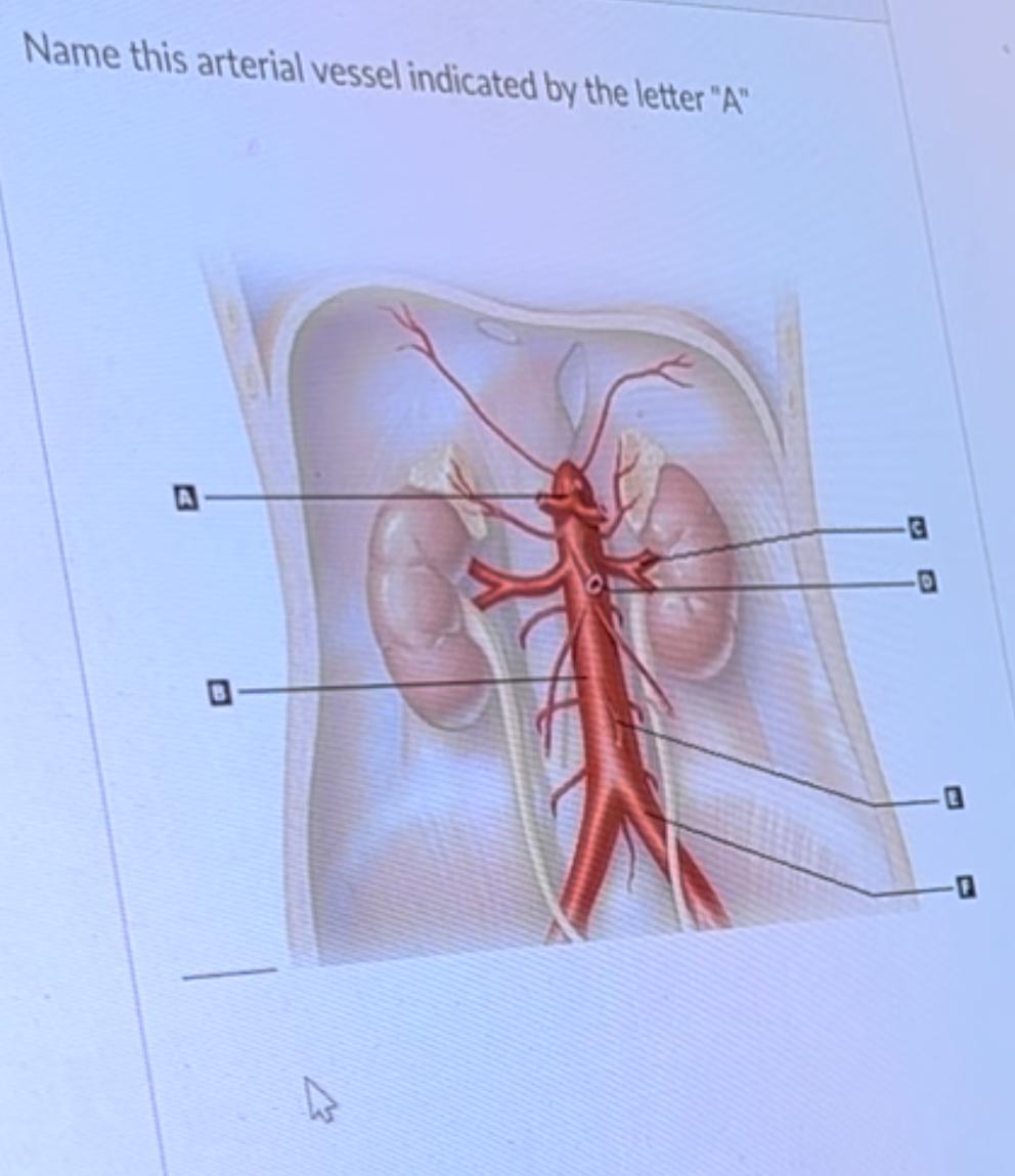 Solved Name this arterial vessel indicated by the letter | Chegg.com