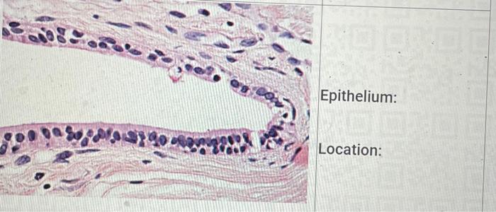 Solved Name the type of epithelium and ONE location example | Chegg.com