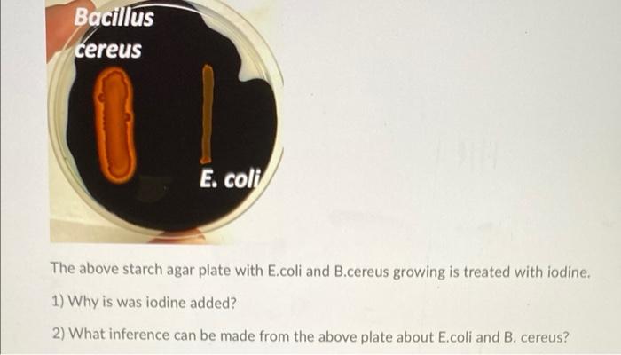 Solved 2 3 4 ASM MicrobeLibrary o MacWillia The above tubes | Chegg.com