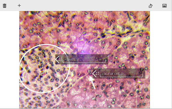 Solved Did I label an acinar cell and islet correctly? | Chegg.com