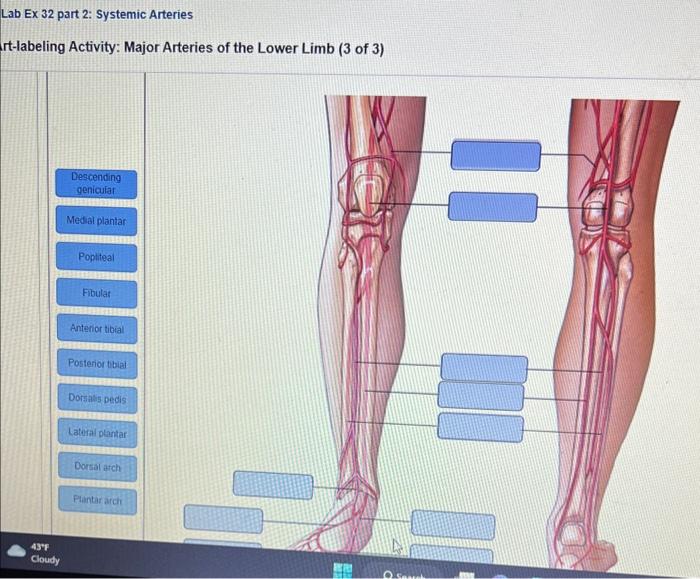 Solved rt-labeling Activity: Major Arteries of the Lower | Chegg.com