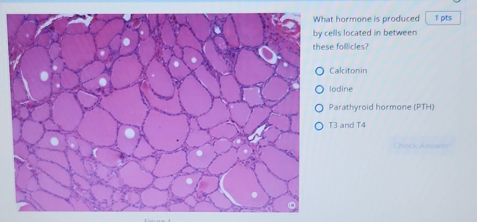Solved What hormone is produced by the gland in Figure 2? | Chegg.com