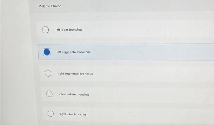 Solved Which structure is highlighted (reference leader | Chegg.com