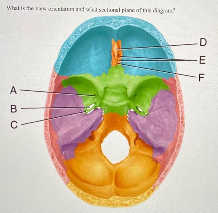 Solved What is the view orientation and what sectional plane | Chegg.com