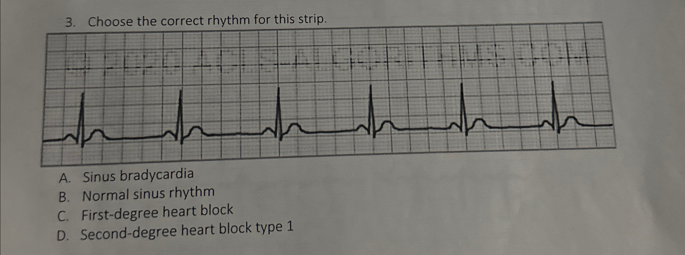 Solved Choose the correct rhythm for this strip.A. ﻿Sinus | Chegg.com