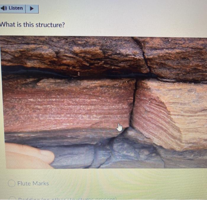 Solved Listen What is this structure? Flute Marks | Chegg.com