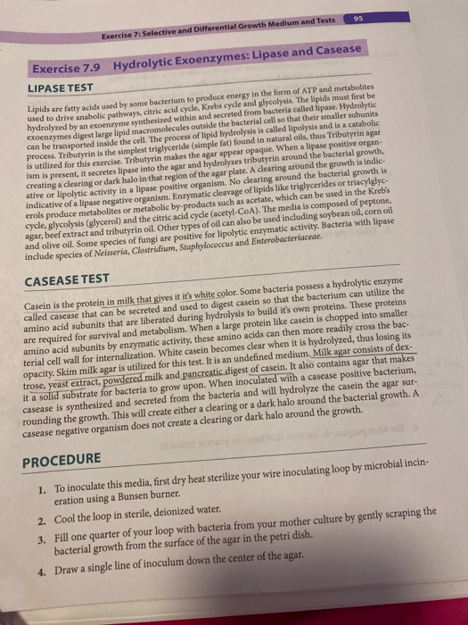 Solved 2. What is the enzyme being tested? 3. What is the | Chegg.com