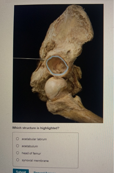 Solved Which structure is highlighted? O acetabular labrum O | Chegg.com