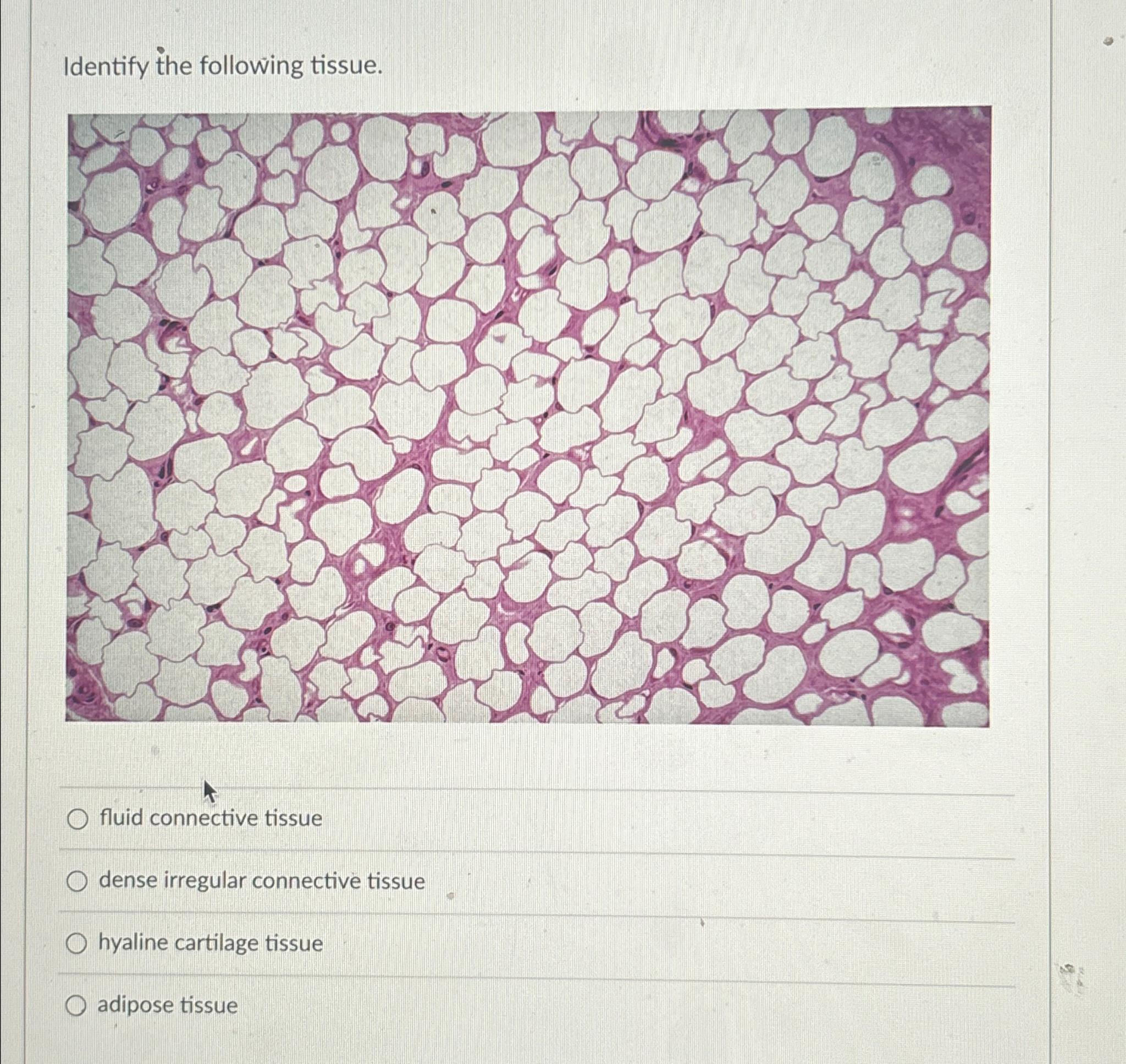 Solved Identify the following tissue.fluid connective | Chegg.com