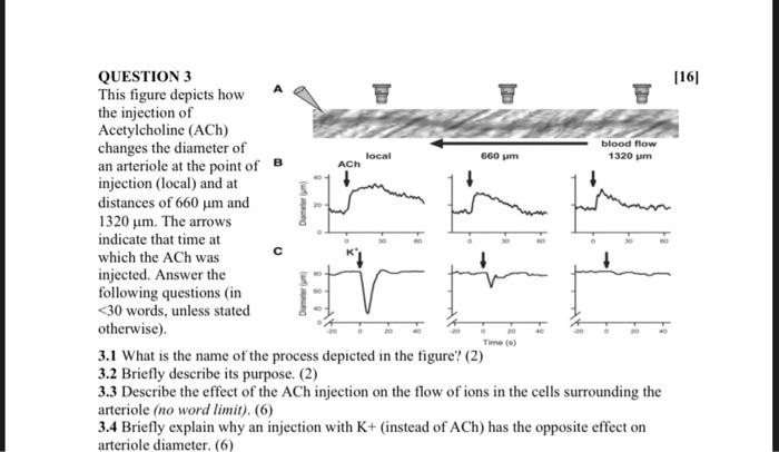 Solved QUESTION 3 This figure depicts how the injection of | Chegg.com