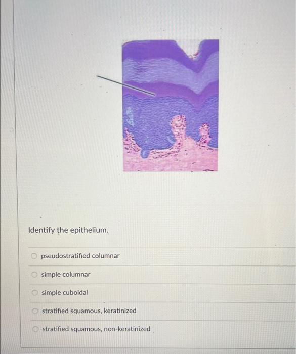 Solved Identify the epithelium. pseudostratified columnar | Chegg.com
