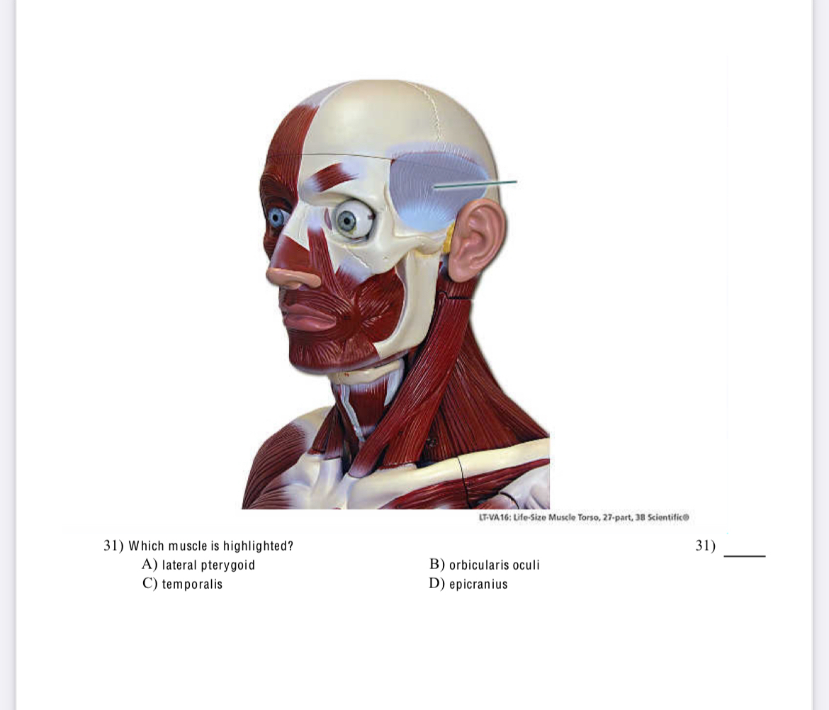 Solved Which muscle is highlighted?A) ﻿lateral pterygoidC) | Chegg.com