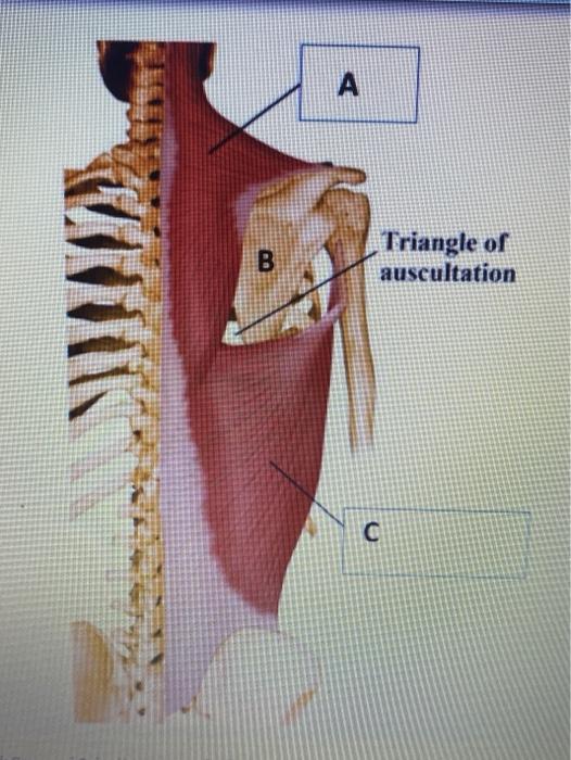 Solved А B Triangle of auscultation C The Triangle of | Chegg.com