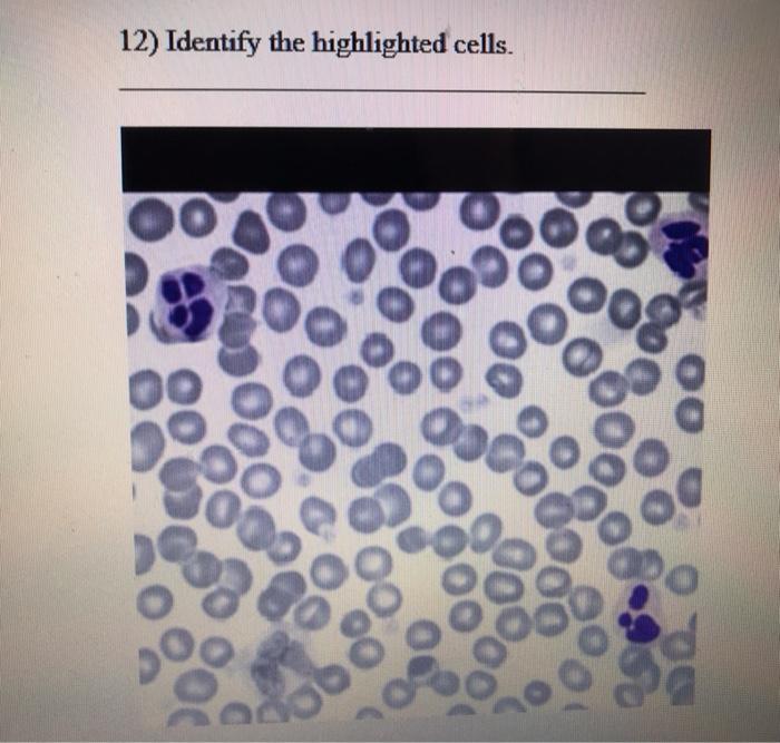 Solved 11) Identify the highlighted cells. ၀၀ လ၅ ။ ၁စီ 12) | Chegg.com