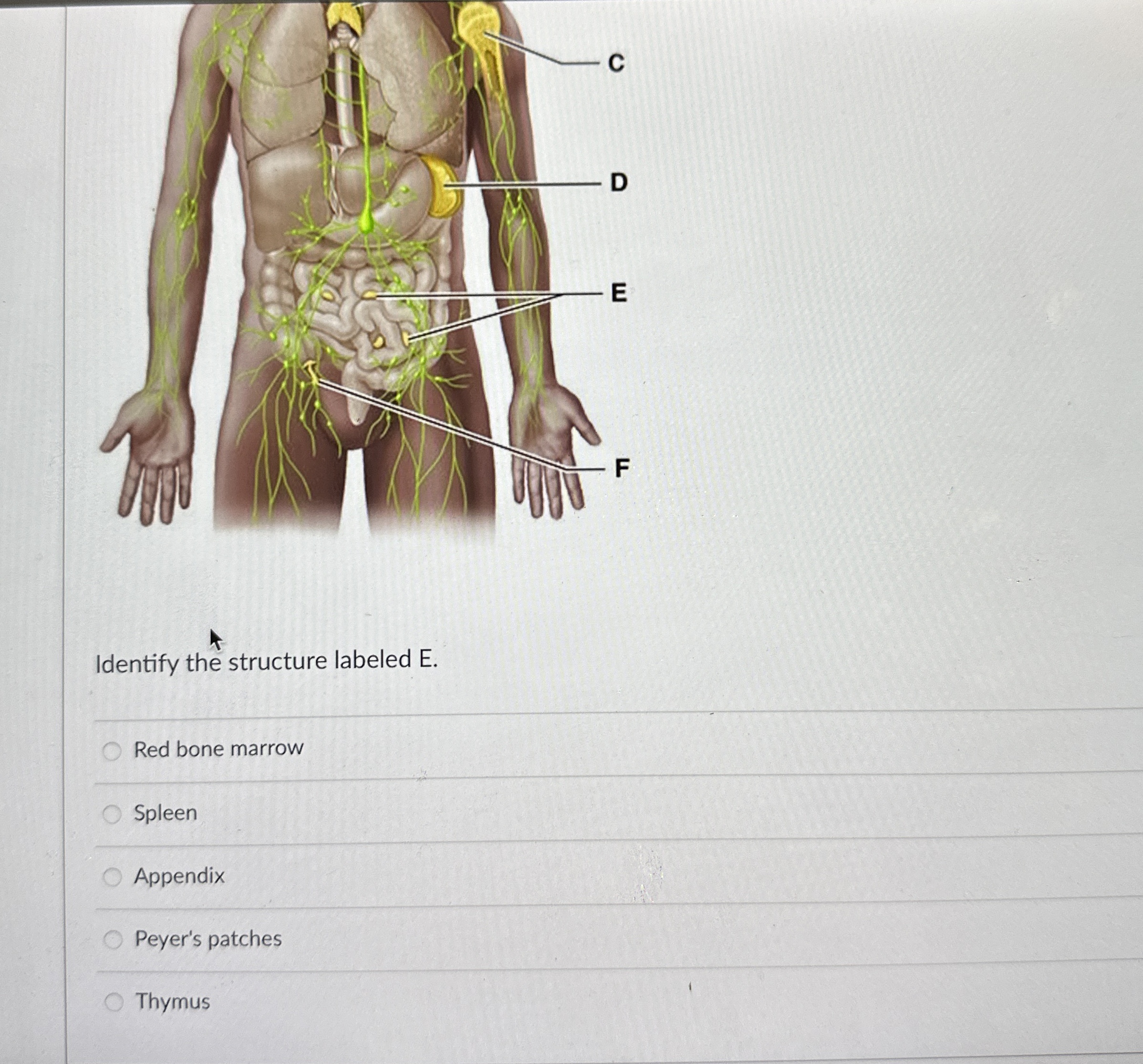 Solved Identify the structure labeled E.Red bone | Chegg.com
