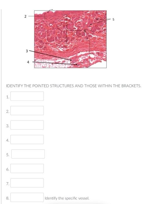 Solved 2 3 4 IDENTIFY THE POINTED STRUCTURES AND THOSE | Chegg.com