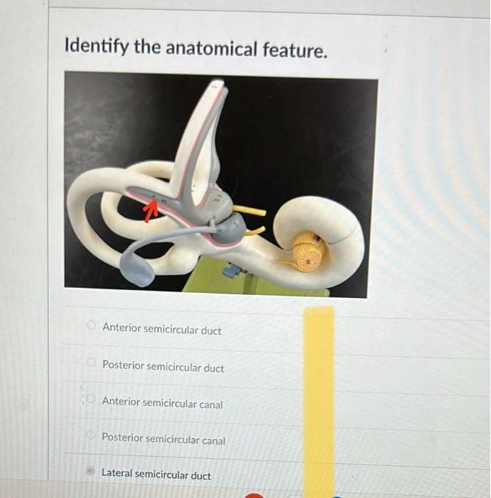 Identify the anatomical feature. Anterior | Chegg.com