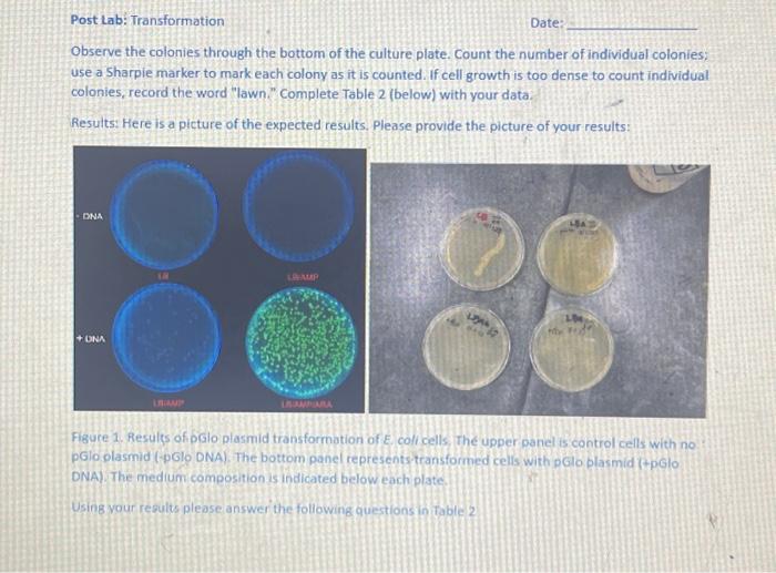 Solved Post Lab Transformation Date Observe The Colonies