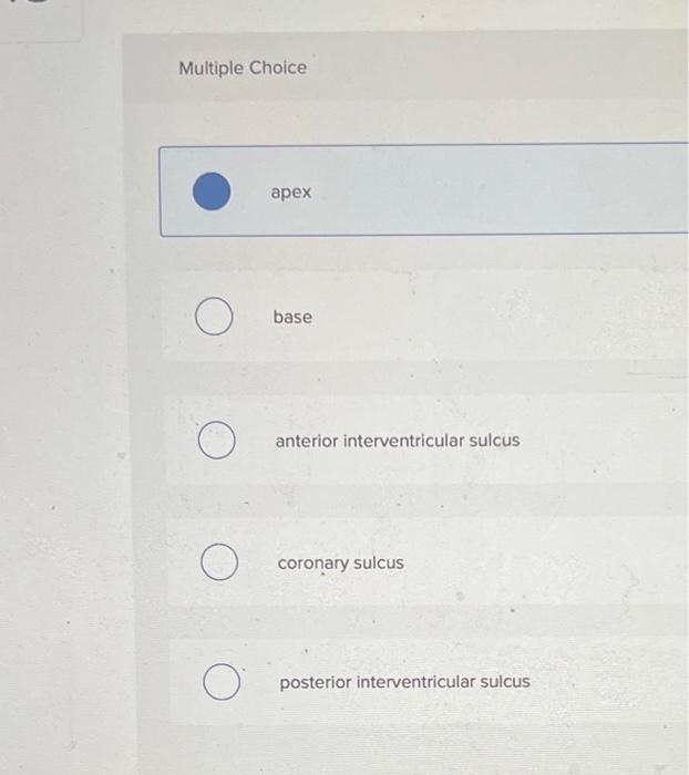 Solved Which structure is highlighted? Multiple Choice | Chegg.com