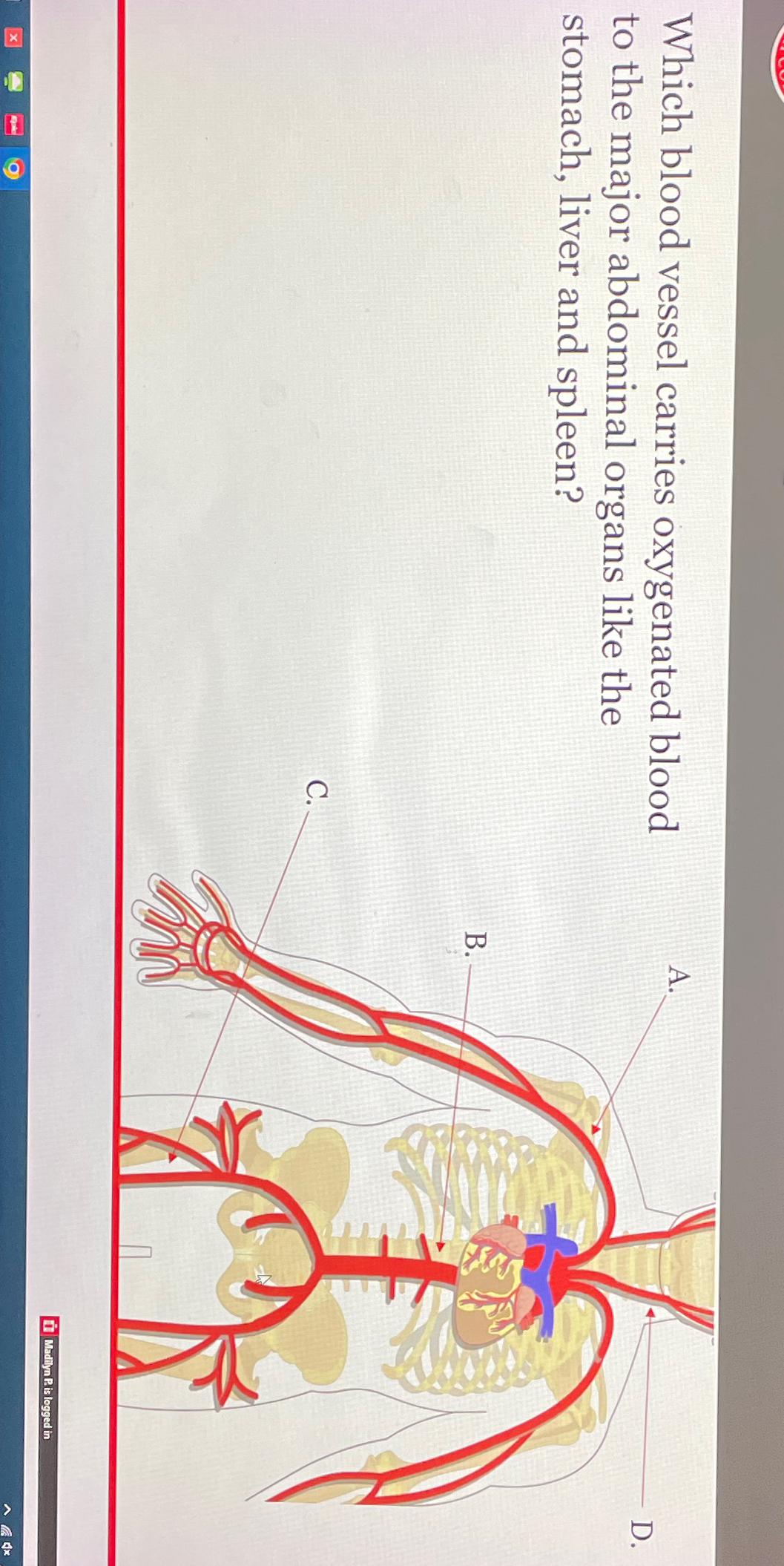 Solved Which blood vessel carries oxygenated blood to the | Chegg.com