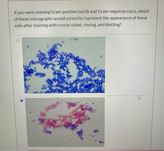 Solved If you were staining Gram-positive bacilli and | Chegg.com