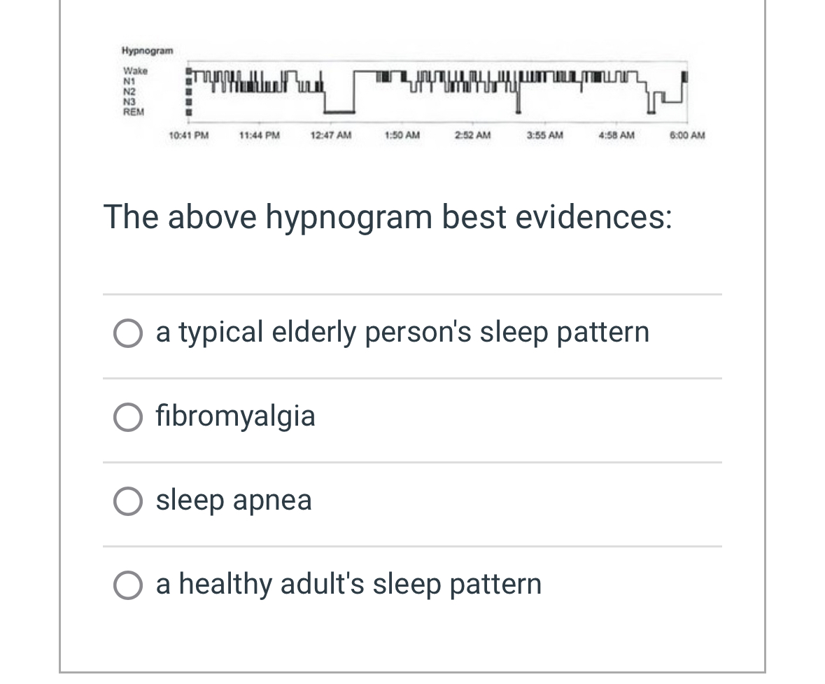 Solved The above hypnogram best evidences:a typical elderly | Chegg.com