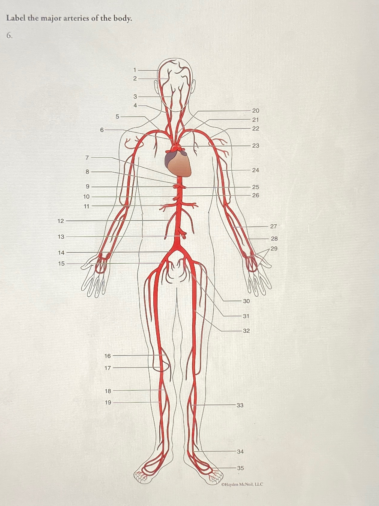 Solved Label the major arteries of the body.6. | Chegg.com