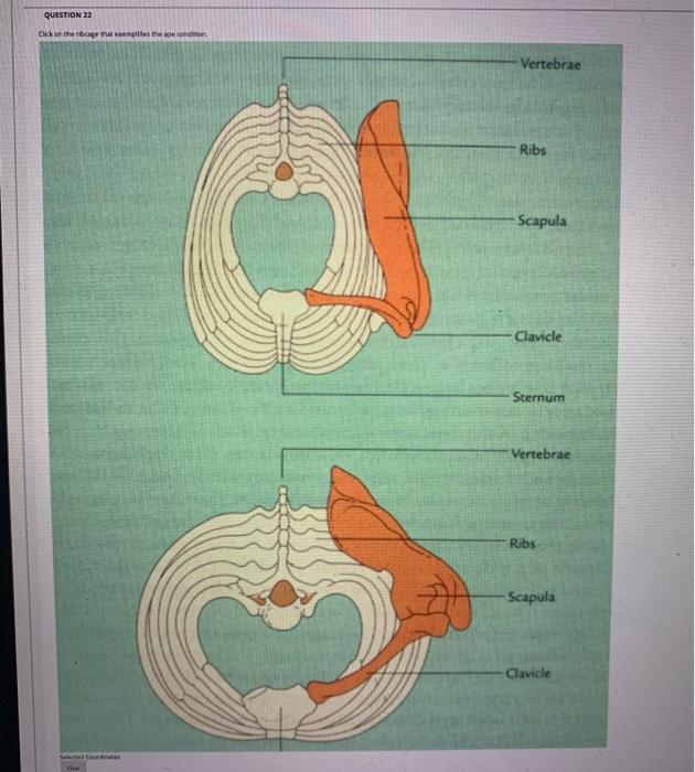 Solved QUESTION 22 Cikkontribcage esplies the seconds | Chegg.com