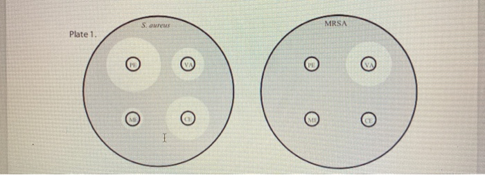 Solved S. aureus MRSA Plate 1. MRSA Plate 2 S. aureus PE | Chegg.com